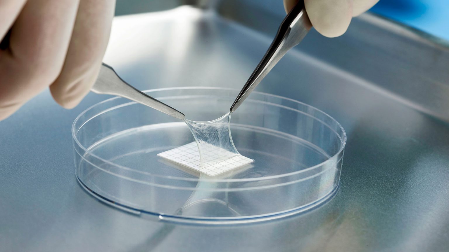 Amniotic Membrane Wound Care for Chronic Wounds and Ulcers | BioTissue