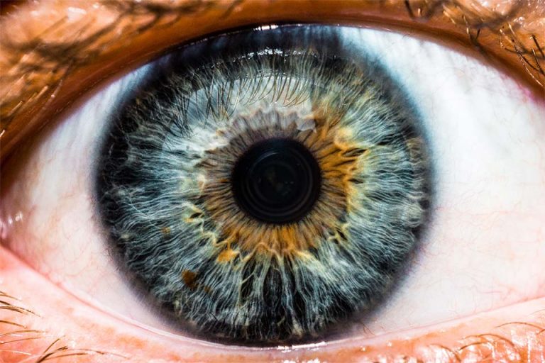 Prokera® Biologic Corneal Bandage | BioTissue