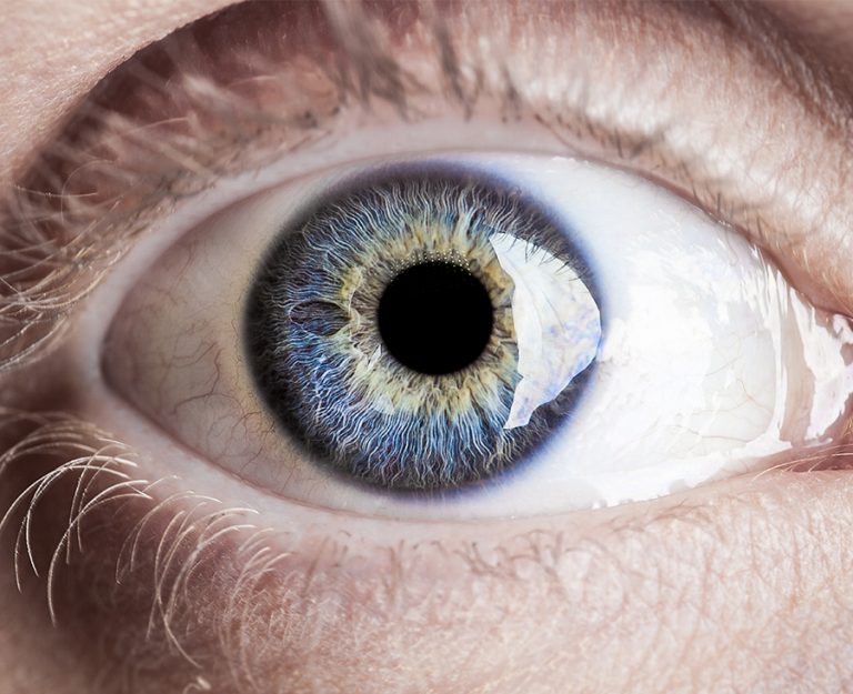 AmnioGuard® Ocular Reconstruction Surgical Graft| BioTissue