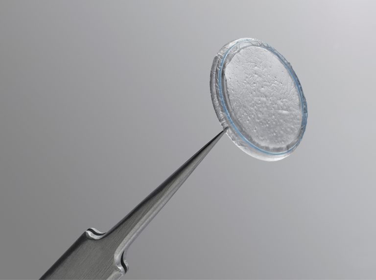 Prokera® Biologic Corneal Bandage | BioTissue