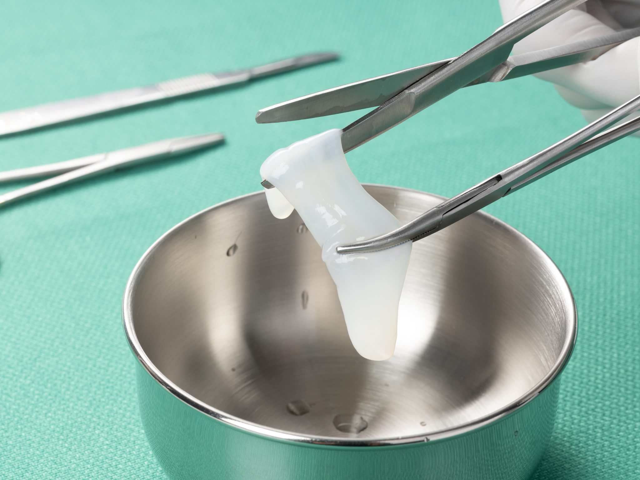 LP - Wounds | BioTissue